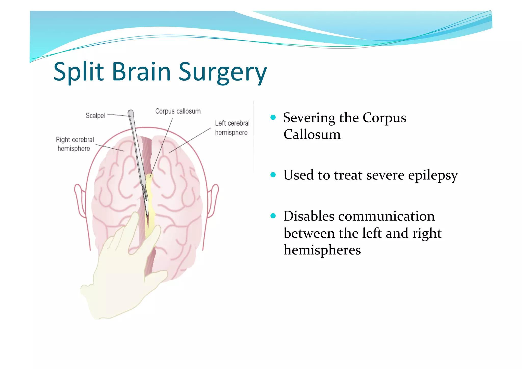 Lesson 8 split brain studies | PDF