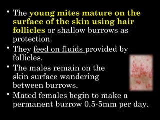 Lesson 8 SCABIES (Skin Diseases Lesson for Nursing Students).pptx