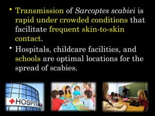 Lesson 8 SCABIES (Skin Diseases Lesson for Nursing Students).pptx