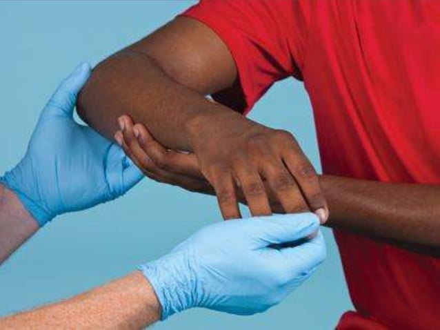 First Aid in fractures | PPTX