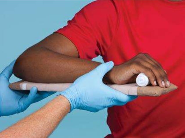 First Aid in fractures