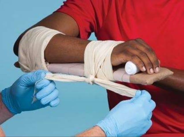 First Aid in fractures