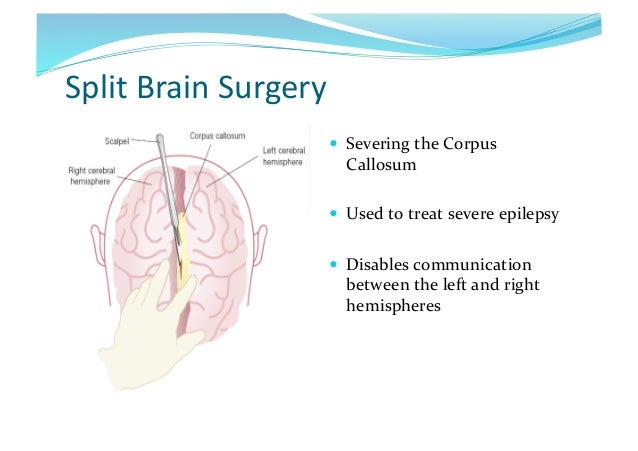(Lesson 9 2013) split brain studies