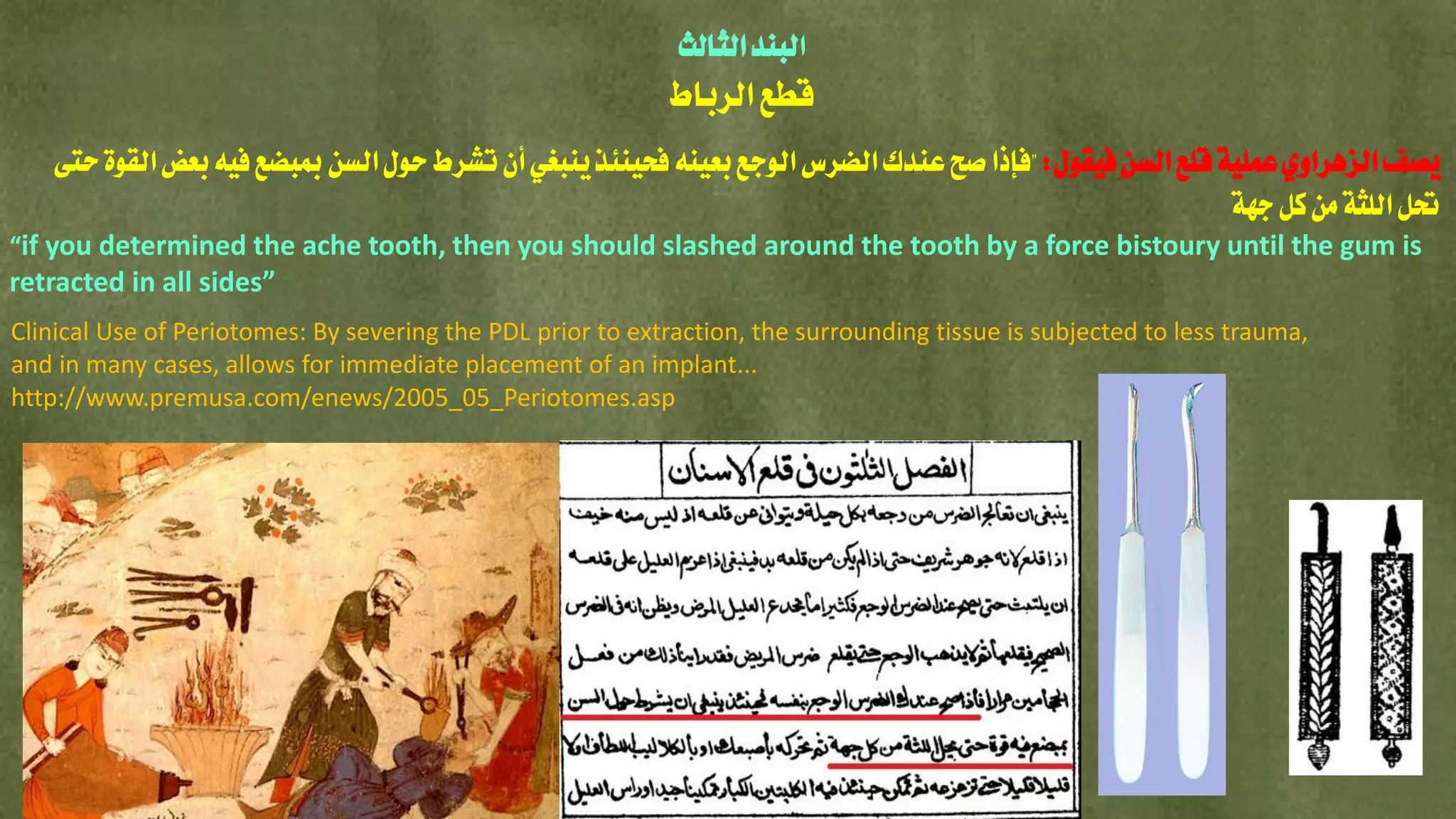 Lesson from Abulcasis | PPT