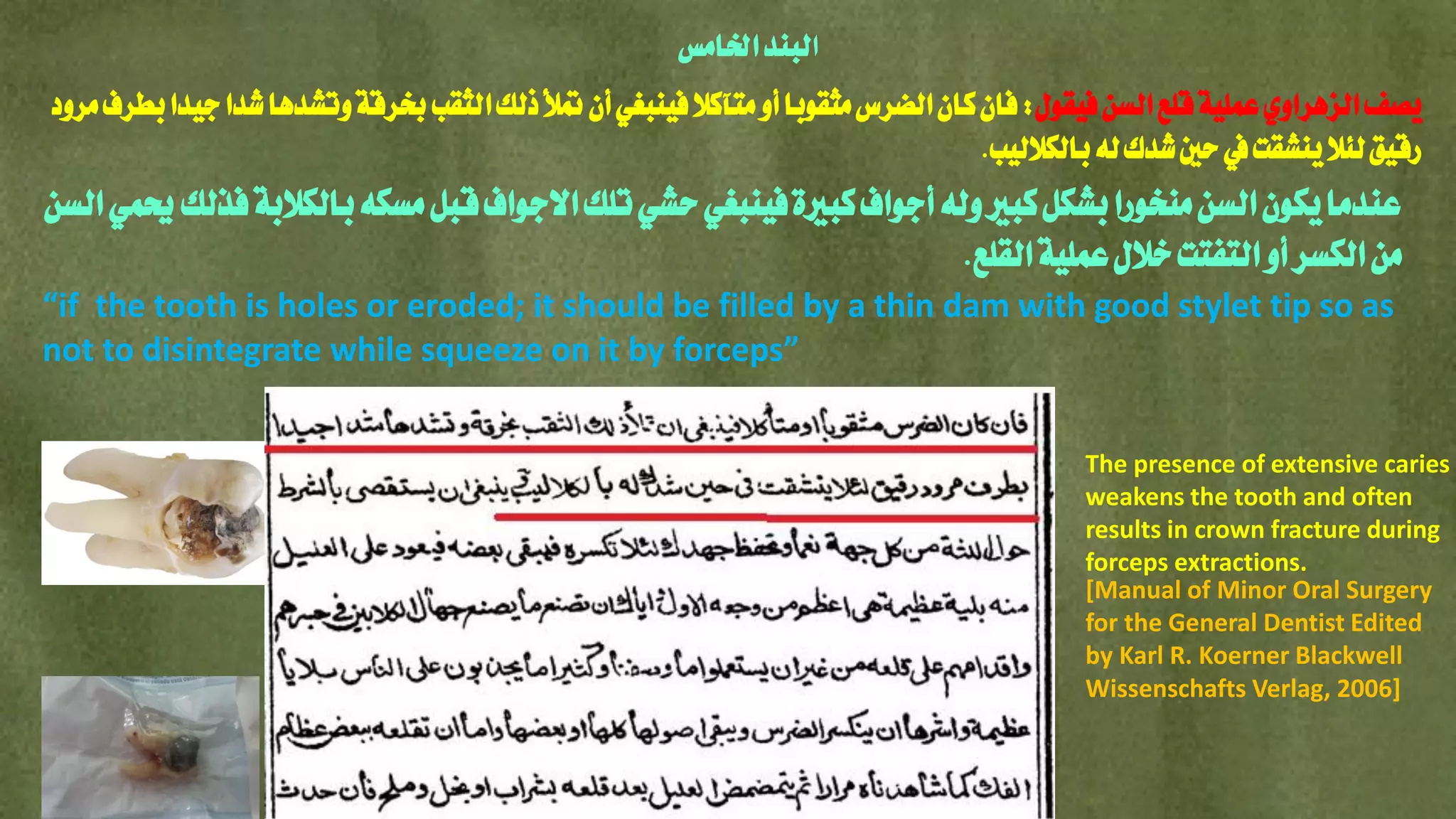 Lesson from Abulcasis | PPT