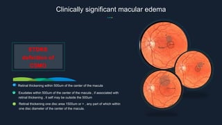 Lessons learned from DRCR protocols | PPTX