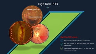 Lessons learned from DRCR protocols | PPTX