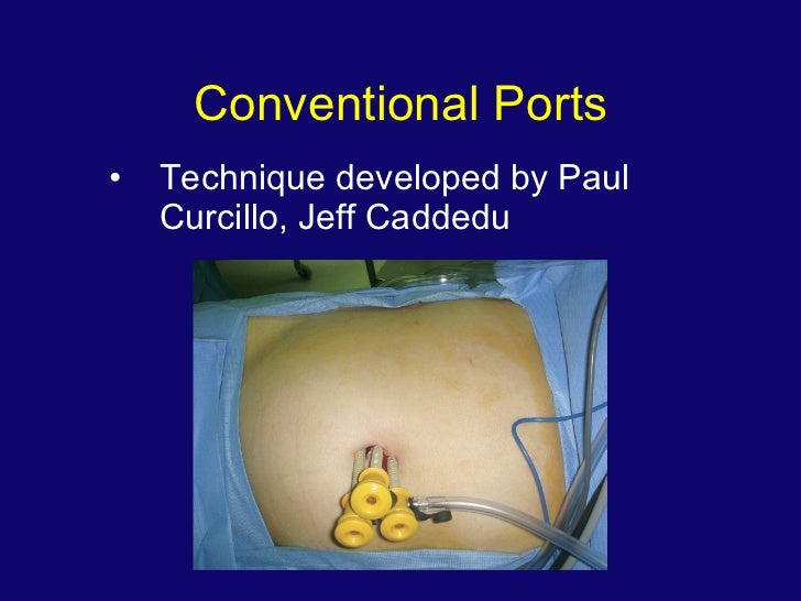 Single Port Technologies