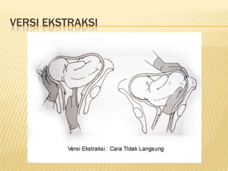 Letak lintang | PPTX