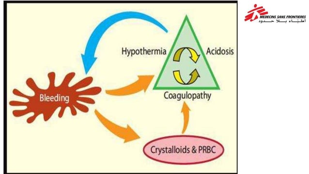 Trauma lethal triad