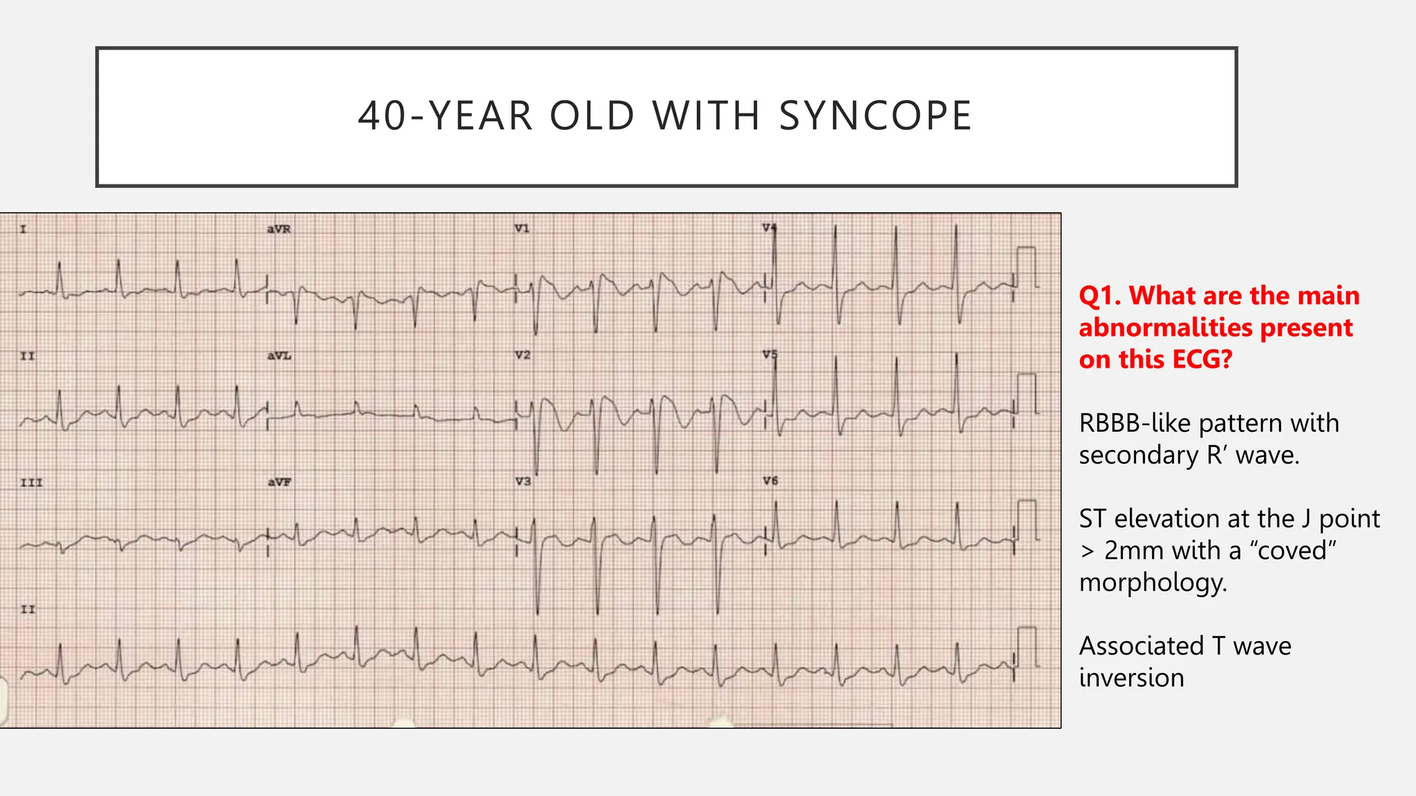 Lethal ECG pattern reading and diagnosis.pptx