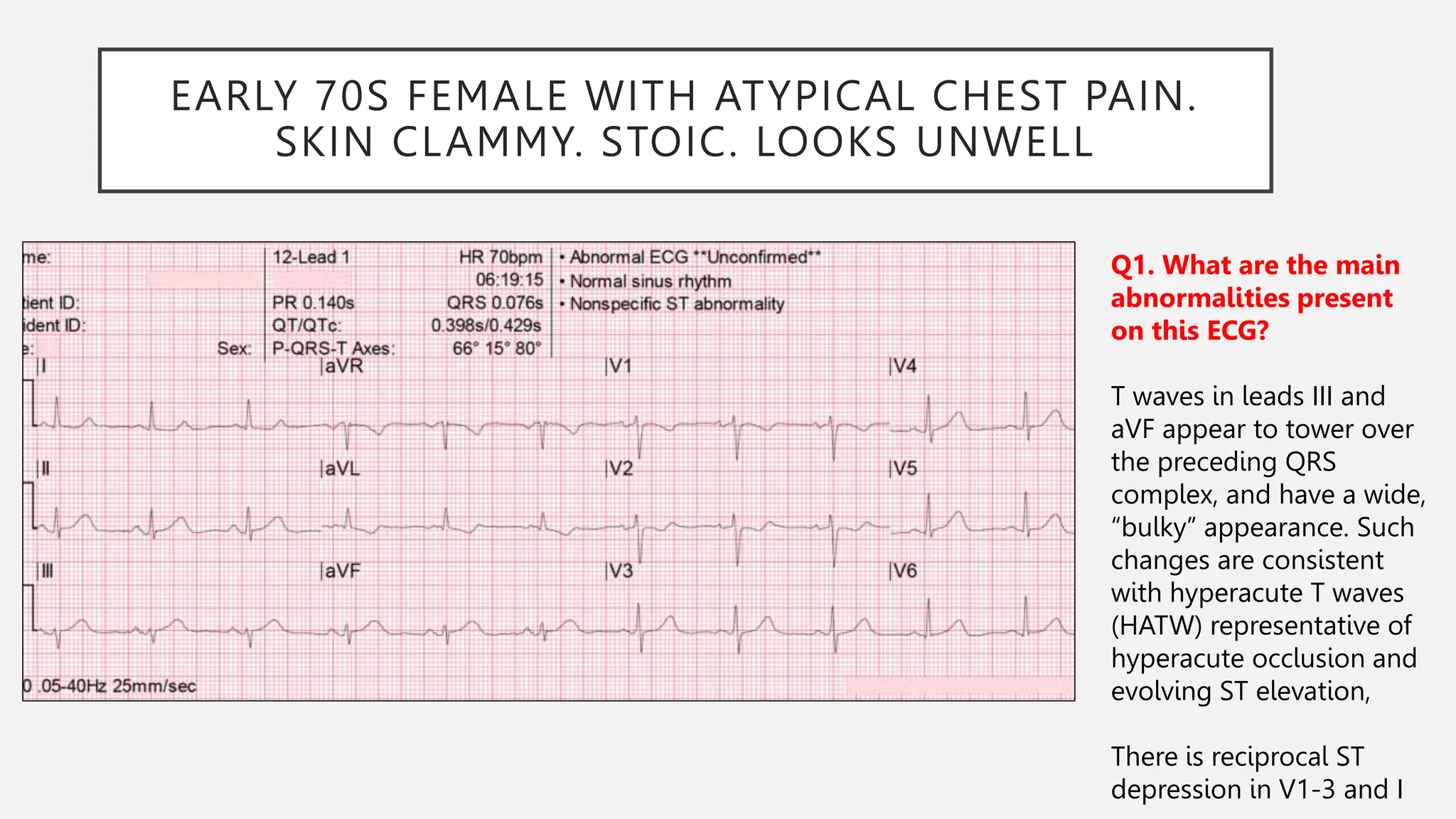 Lethal ECG pattern reading and diagnosis.pptx