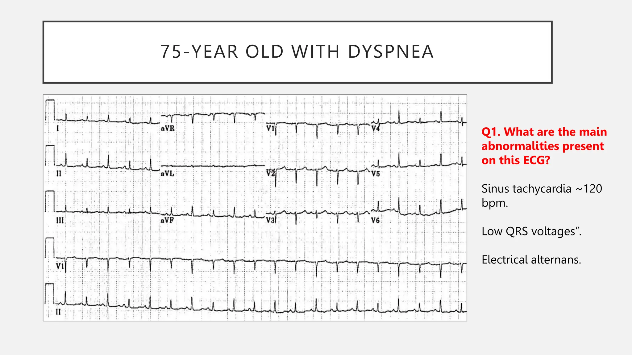 Lethal ECG pattern reading and diagnosis.pptx