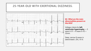 Lethal ECG pattern reading and diagnosis.pptx