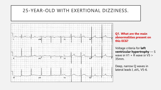 Lethal ECG pattern reading and diagnosis.pptx