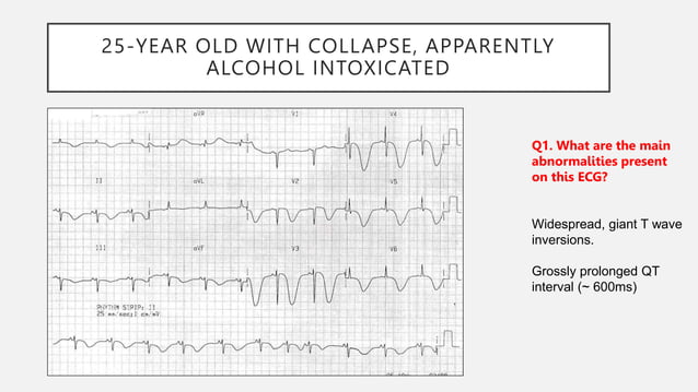 Lethal ECG pattern reading and diagnosis.pptx