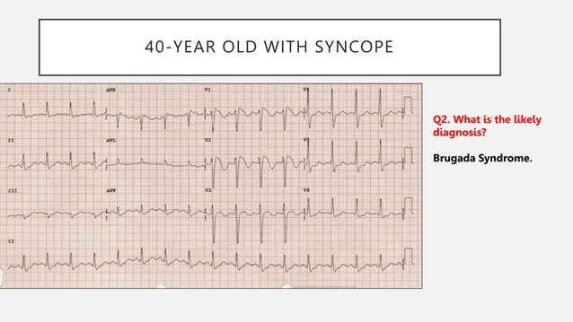 Lethal ECG pattern reading and diagnosis.pptx