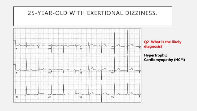 Lethal ECG pattern reading and diagnosis.pptx