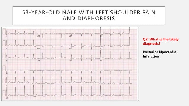 Lethal ECG pattern reading and diagnosis.pptx