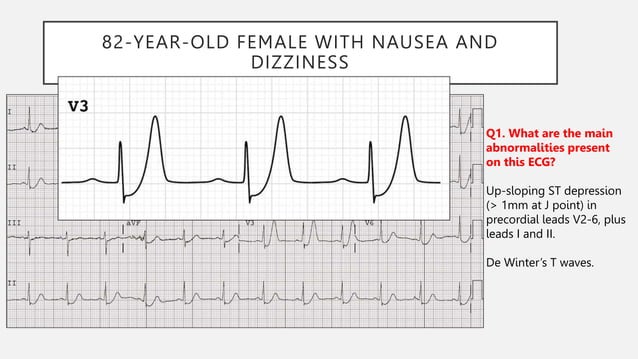 Lethal ECG pattern reading and diagnosis.pptx