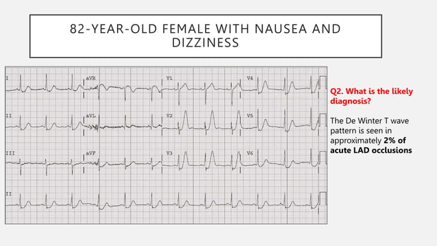 Lethal ECG pattern reading and diagnosis.pptx