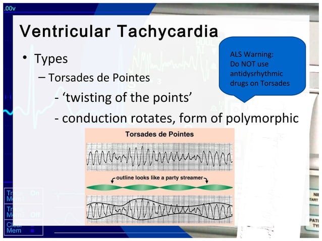 Lethal Cardiac Rhythms - Manual Defibrillation | PPT