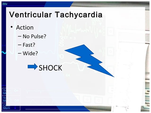 Lethal Cardiac Rhythms - Manual Defibrillation | PPT