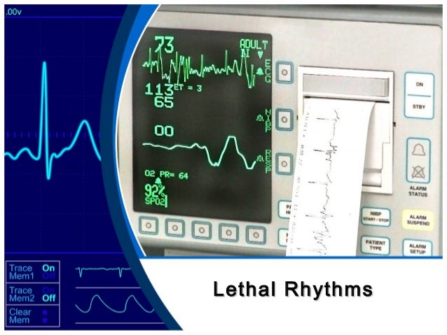 Lethal Cardiac Rhythms - Manual Defibrillation