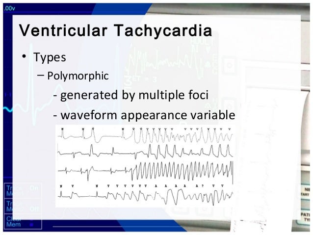 Lethal Cardiac Rhythms - Manual Defibrillation