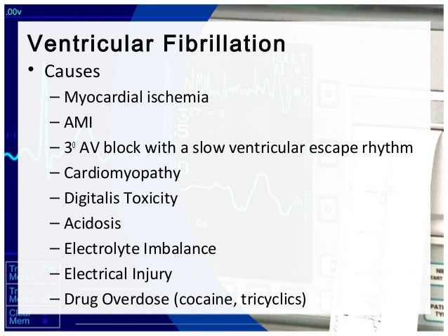 Lethal Cardiac Rhythms - Manual Defibrillation