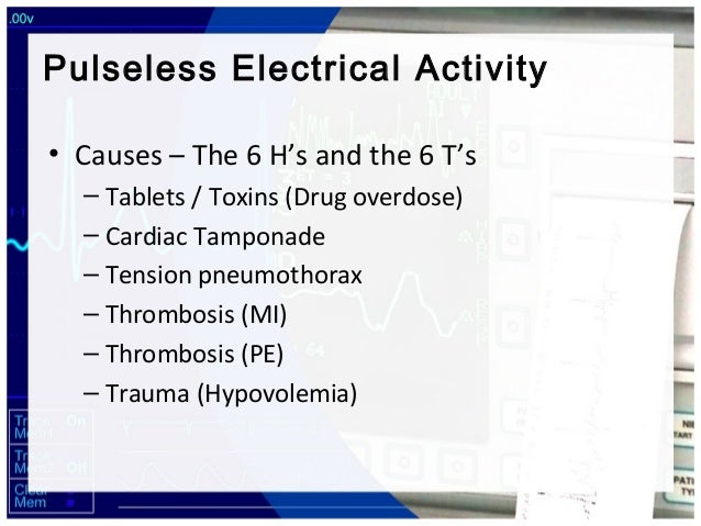 Lethal Cardiac Rhythms - Manual Defibrillation