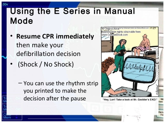 Lethal Cardiac Rhythms - Manual Defibrillation
