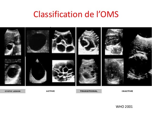 Le traitement non chirurgical du khf