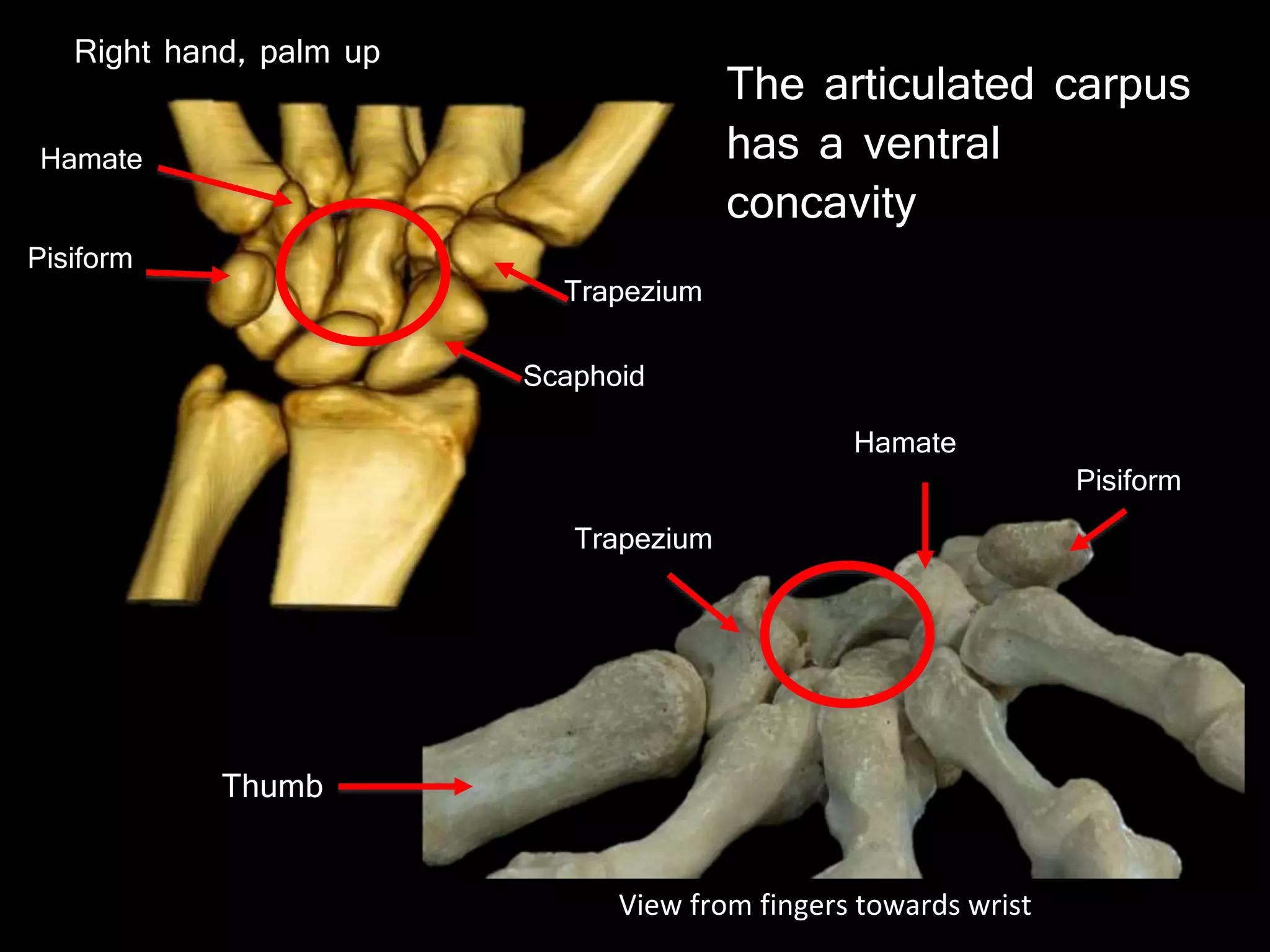 Slideshow: Carpus and Hand Bones | PPTX