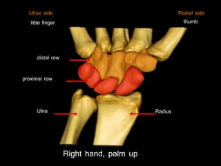 Slideshow: Carpus and Hand Bones | PPTX