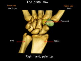 Slideshow: Carpus and Hand Bones | PPTX