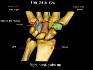 Slideshow: Carpus and Hand Bones | PPTX