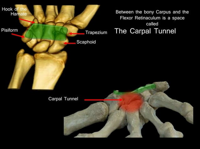 Slideshow: Carpus and Hand Bones | PPT