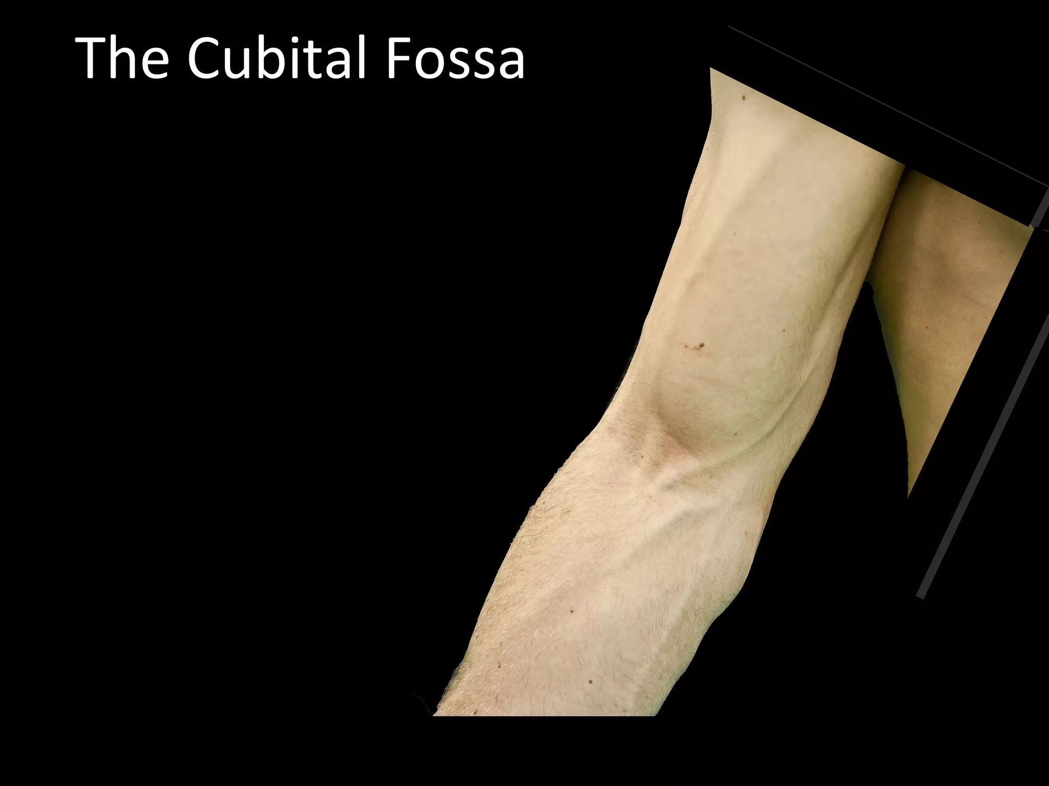 Slideshow: Cubital Fossa | PPT