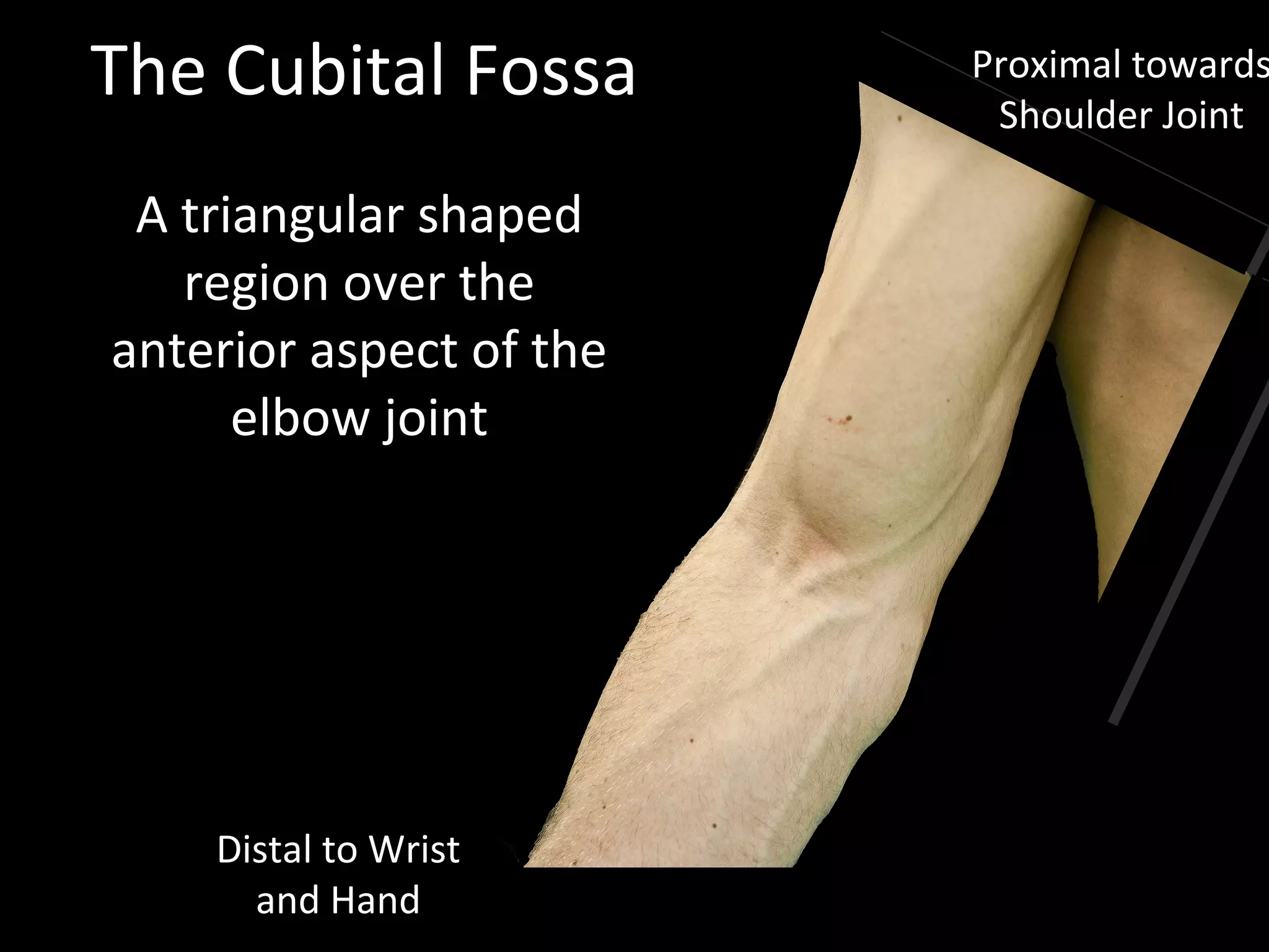 Slideshow: Cubital Fossa | PPT | Death, Injury, or Military Conflict ...