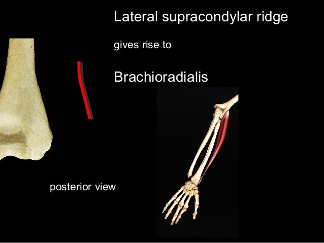 Lateral And Medial Supracondylar Ridges