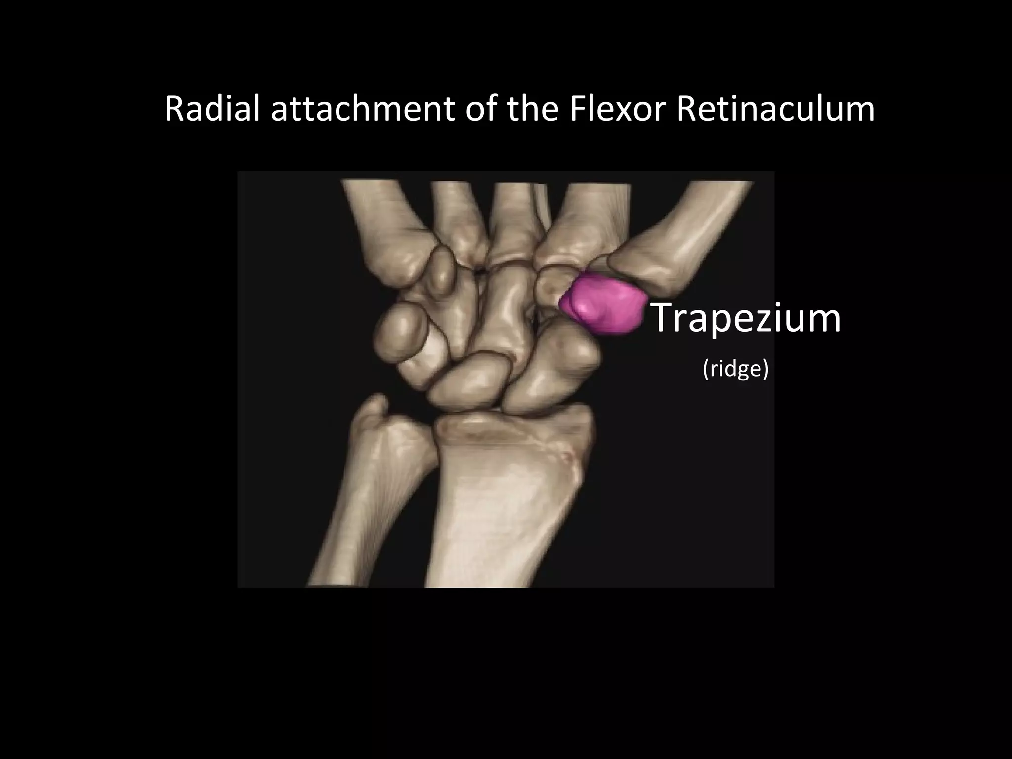 Slideshow: Carpal Tunnel | PPT