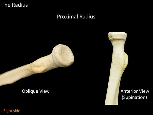 Slideshow: Radius | PPT
