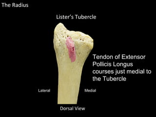 Listers Tubercle Of Radius