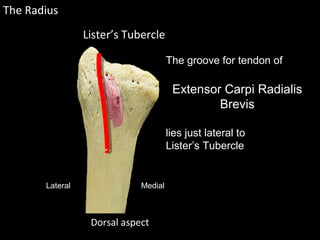 Dorsal Tubercle Of Radius Bone