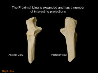 Right Ulna
