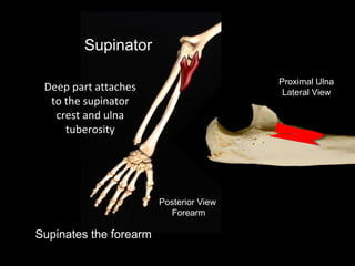 Ulnar Tuberosity