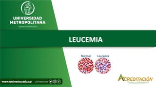 Leucemia | PPTX