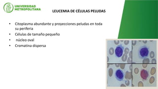 Leucemia | PPTX