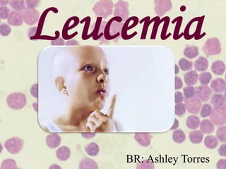Leucemia definicion etiologia y manifestaciones clinicas.pptx